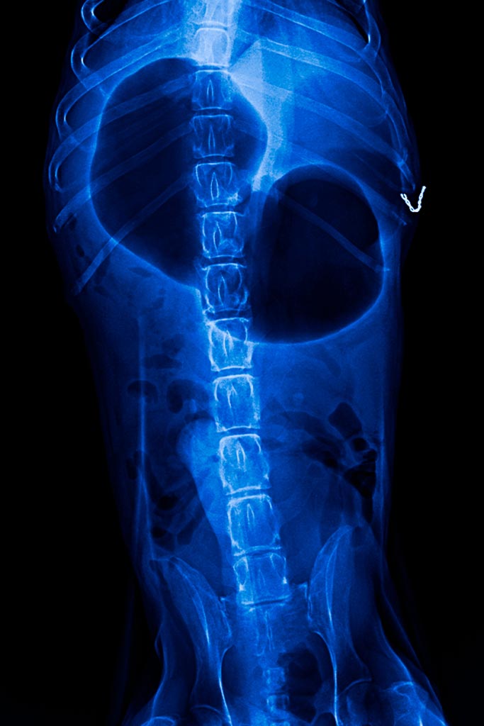 What Are the First Signs of Bloat in a Dog? | Rise Pet Health